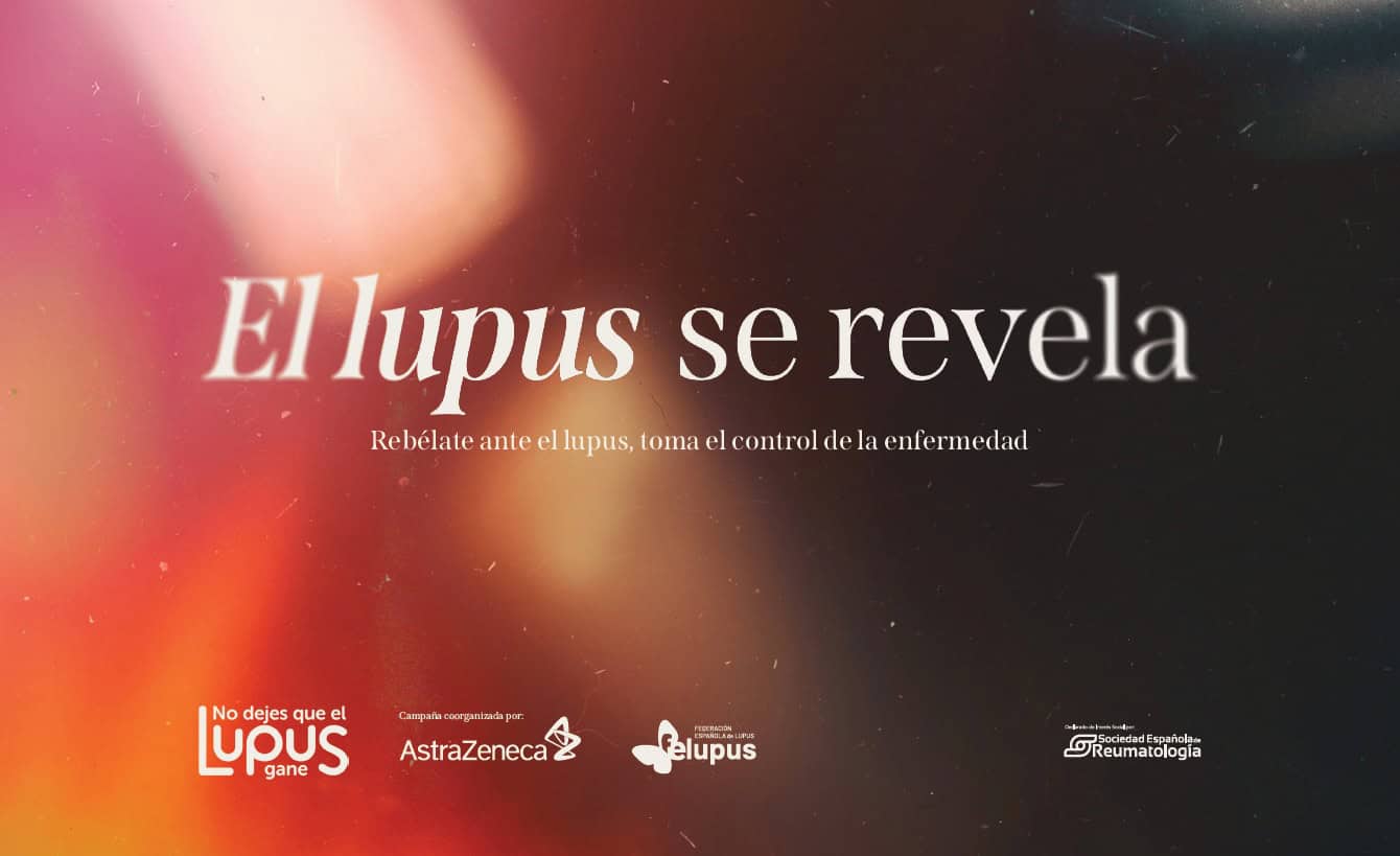Federación Española de Lupus – FELUPUS
